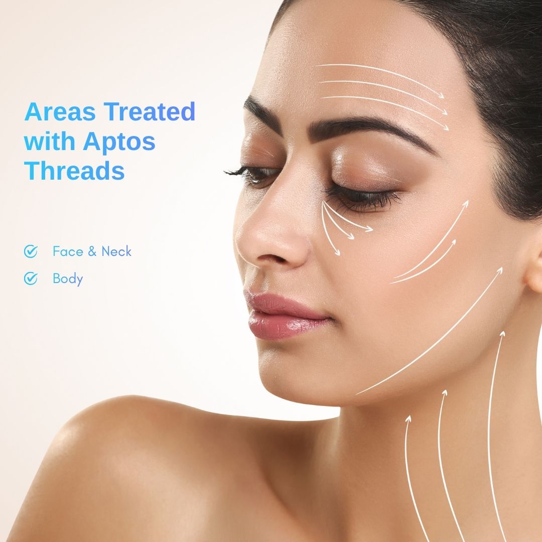 Aptos Dubai | Non-Surgical Face & Body Thread Lift