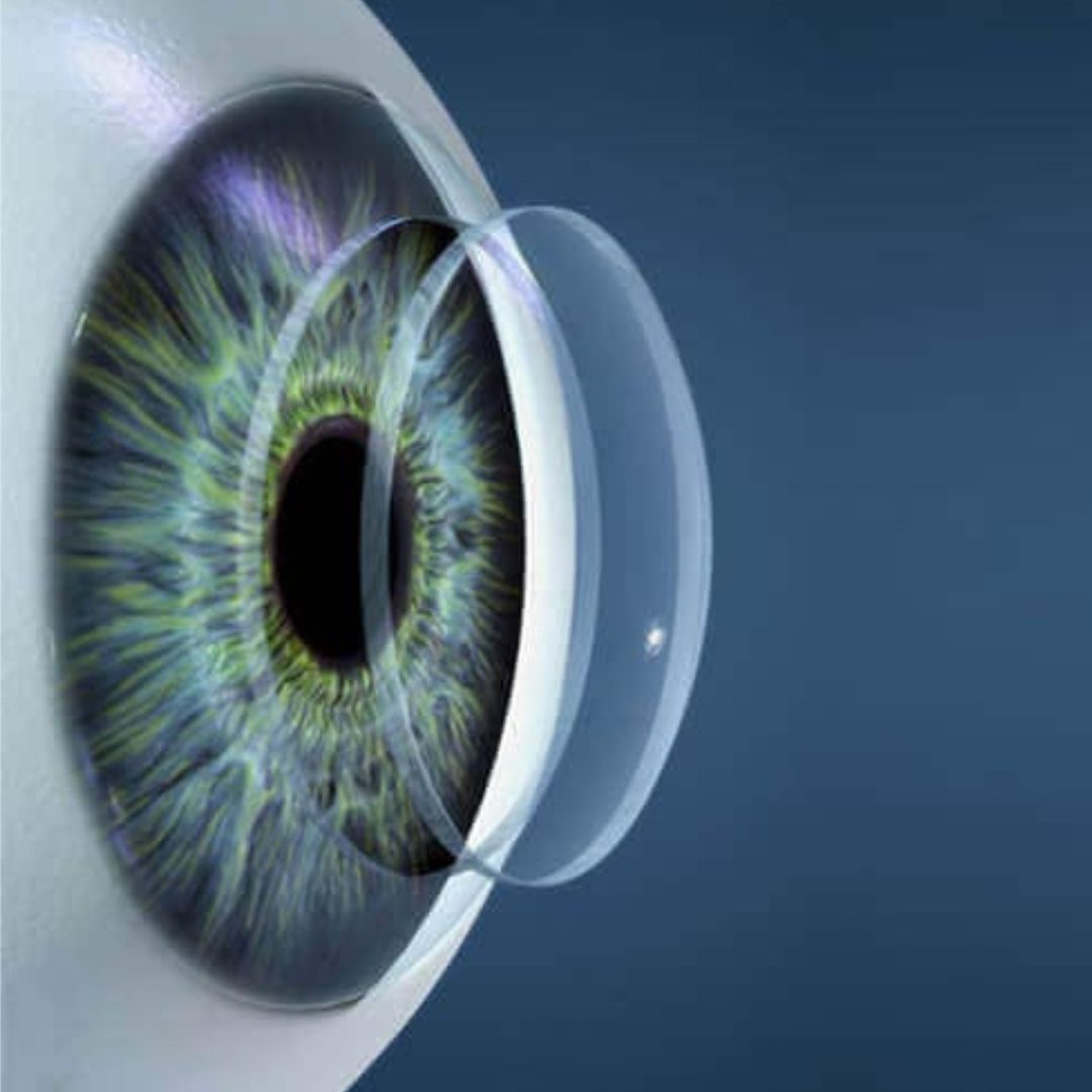 The Leading Eye Clinic in Dubai | New Al Shefa Clinic JLT