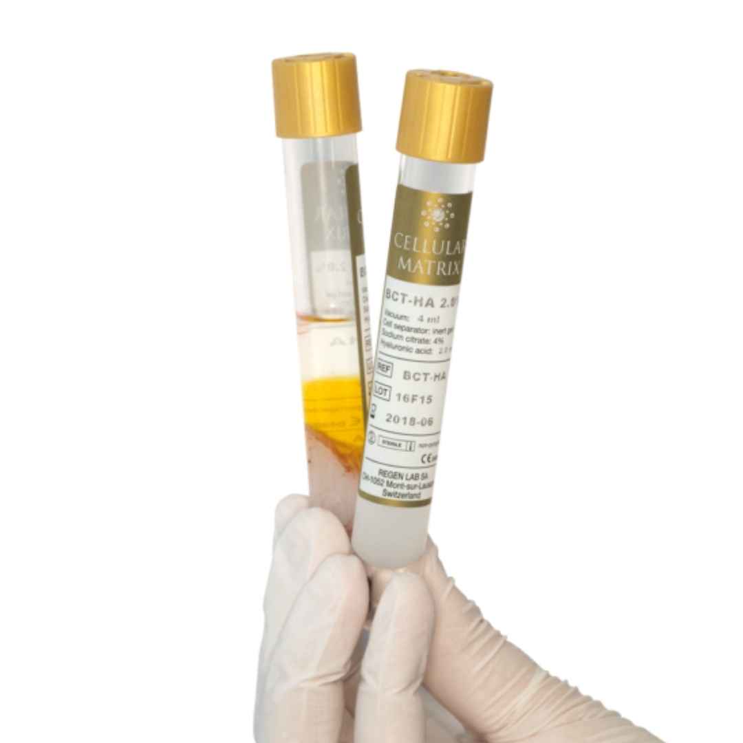 PRP Treatment Dubai | PRP Hair & Skin Treatment
